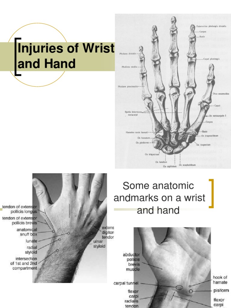 Injuries of Wrist and Hand | PDF | Hand | Arm