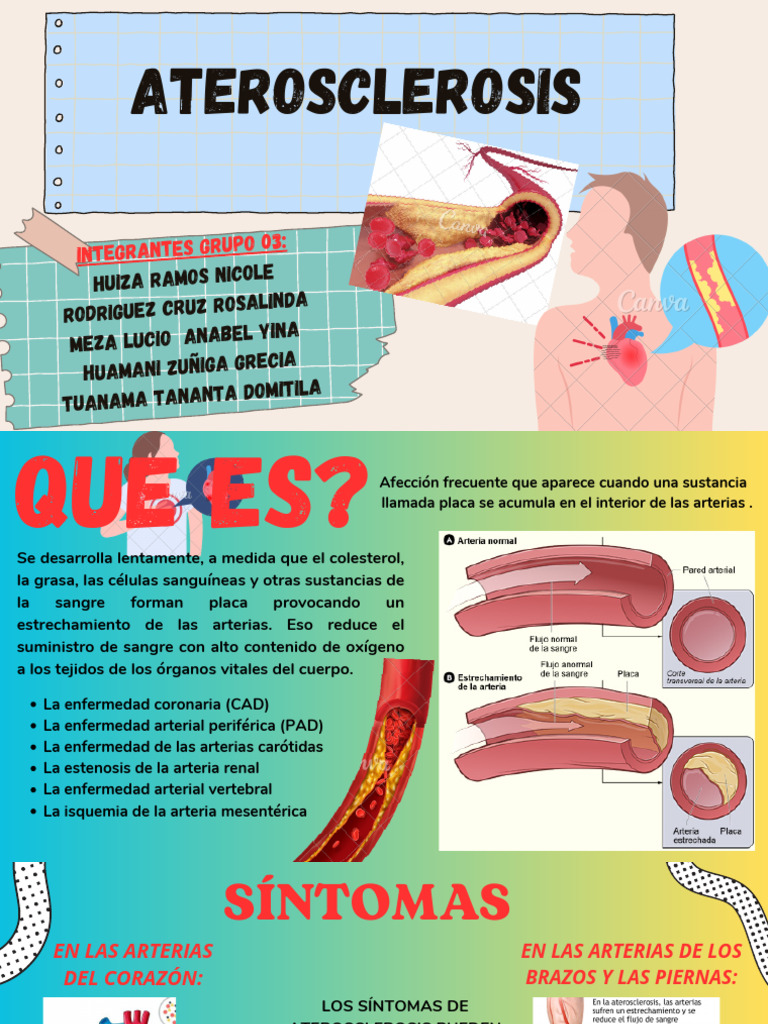 Aterosclerosis: Síntomas y Tratamientos | PDF | Aterosclerosis ...