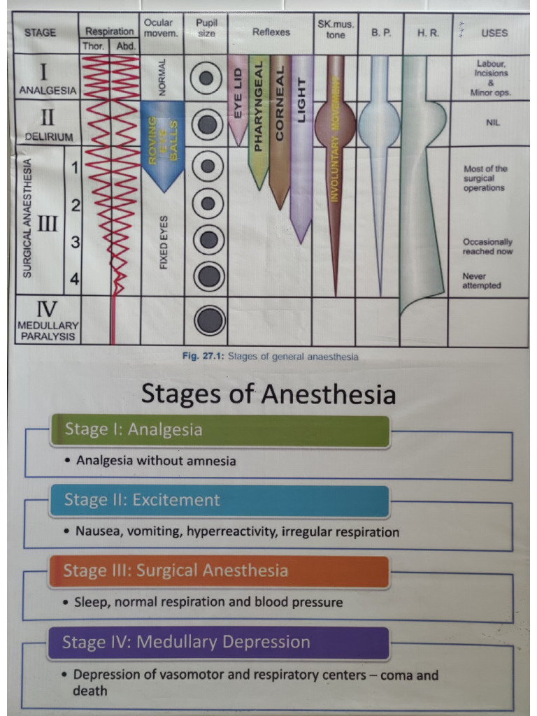3 Stages of General Anesthesia (25-10-2022) | PDF
