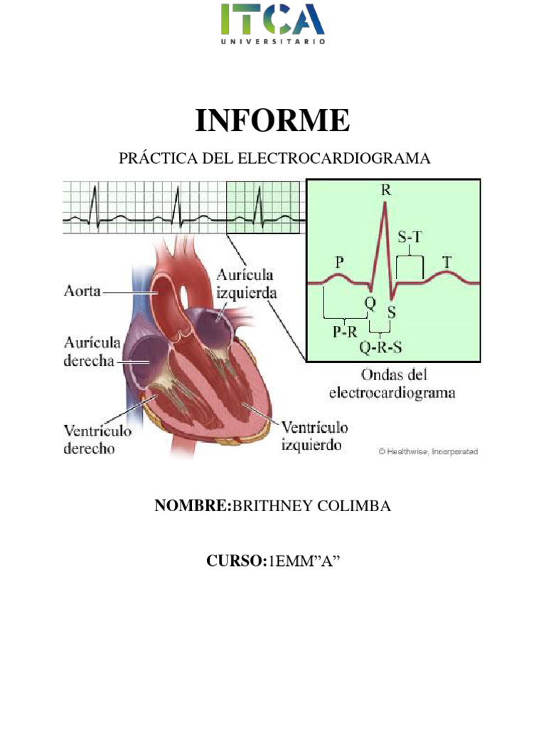 Informe Electrocardiograma | PDF | Electrocardiografia | Órgano (anatomía)