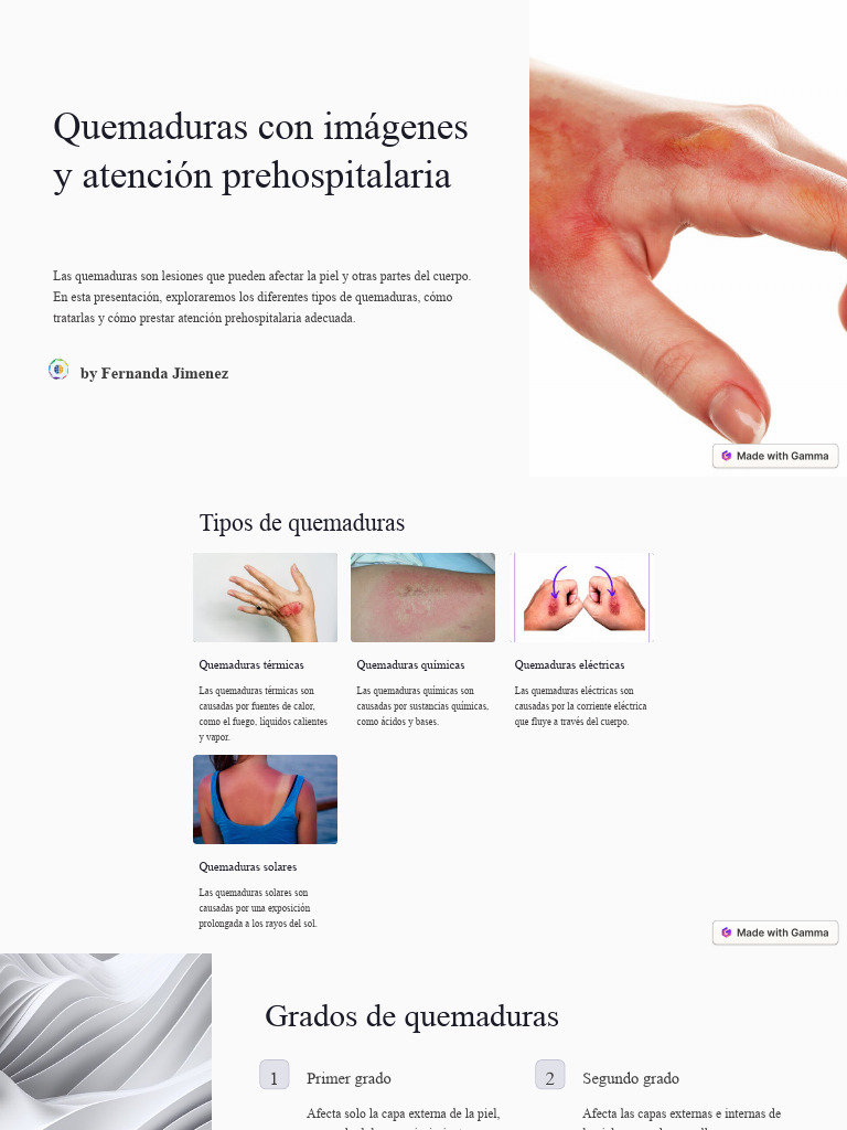 Tipos y tratamiento de quemaduras | PDF | Quemar | Causas de la muerte
