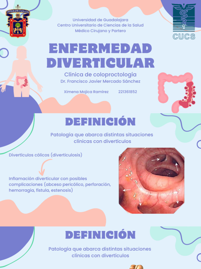 Enfermedad Diverticular | PDF | Cáncer colonrectal | Ciencias de la Salud