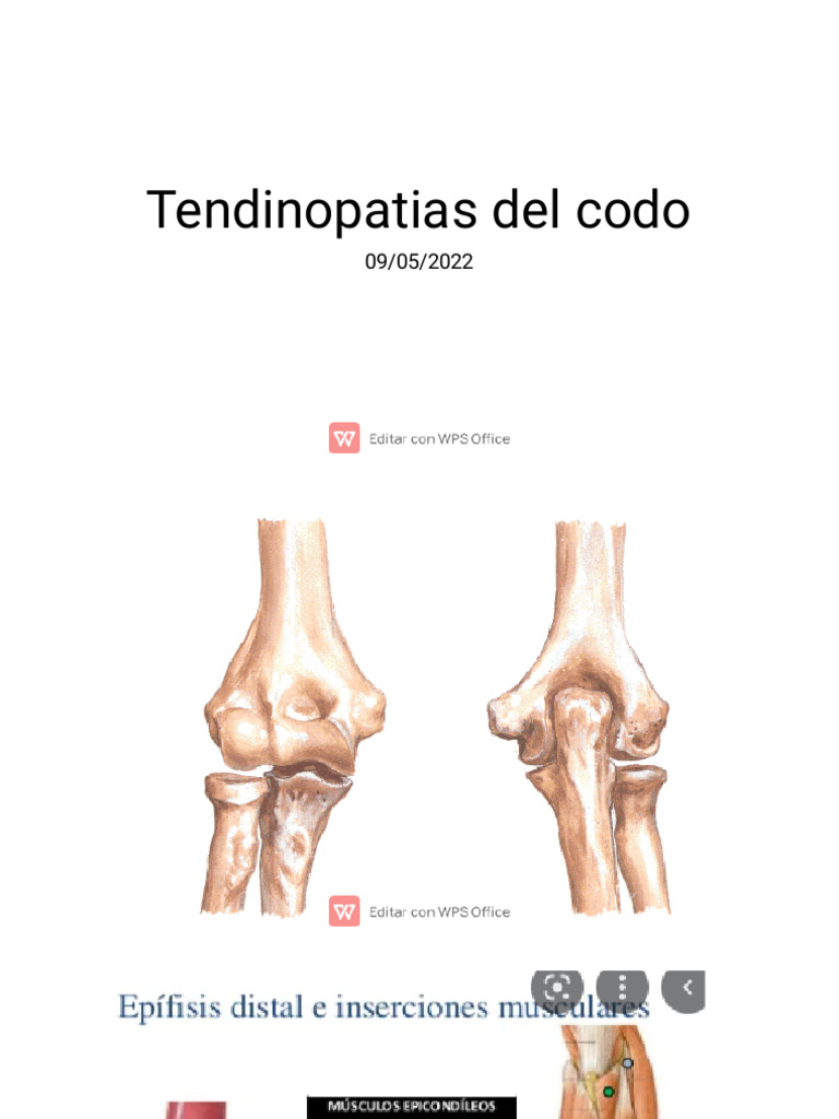 Tendinopatias Del Codo | PDF | Codo | Enfermedades y trastornos