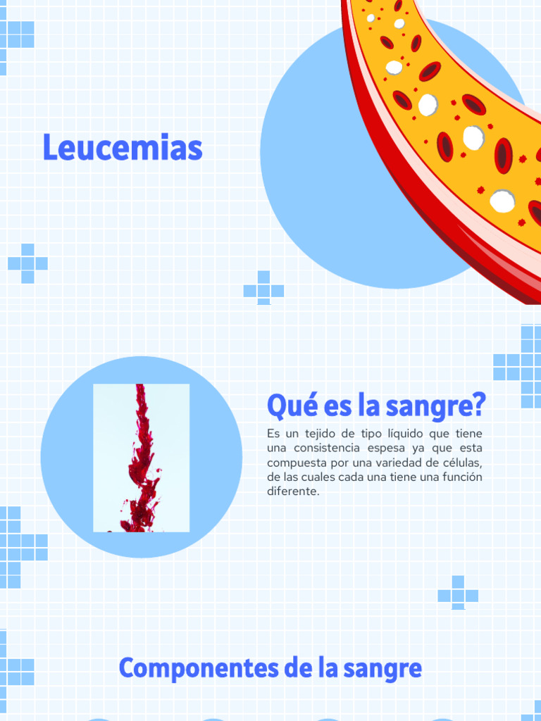 Leucemia | PDF | Leucemia | Sangre