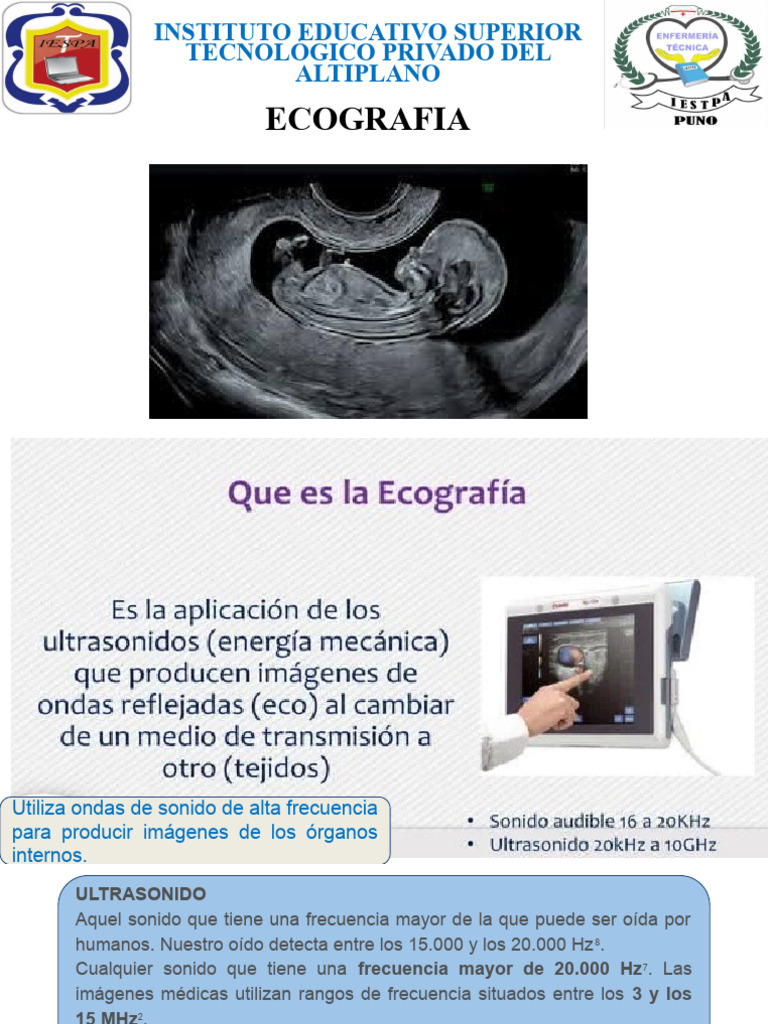 ecografía | PDF | Ultrasonido médico | Sonido
