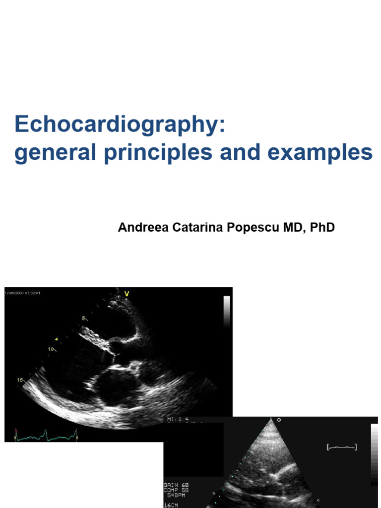 Echocardiography General Principles and Examples | PDF | Science ...