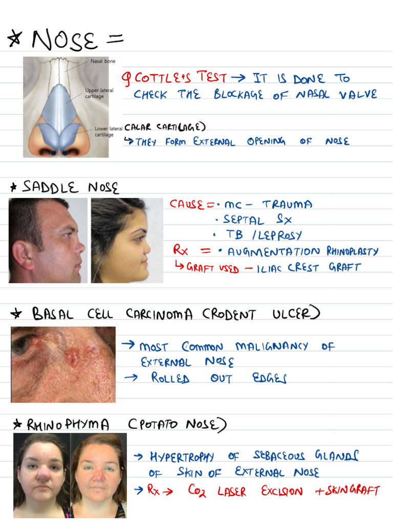 Ent Quick Recap | PDF | Human Nose | Ear