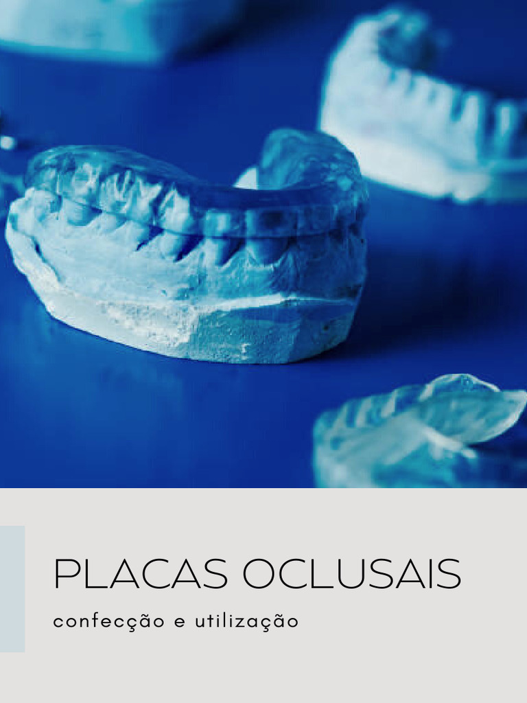 Placas Oclusais | PDF