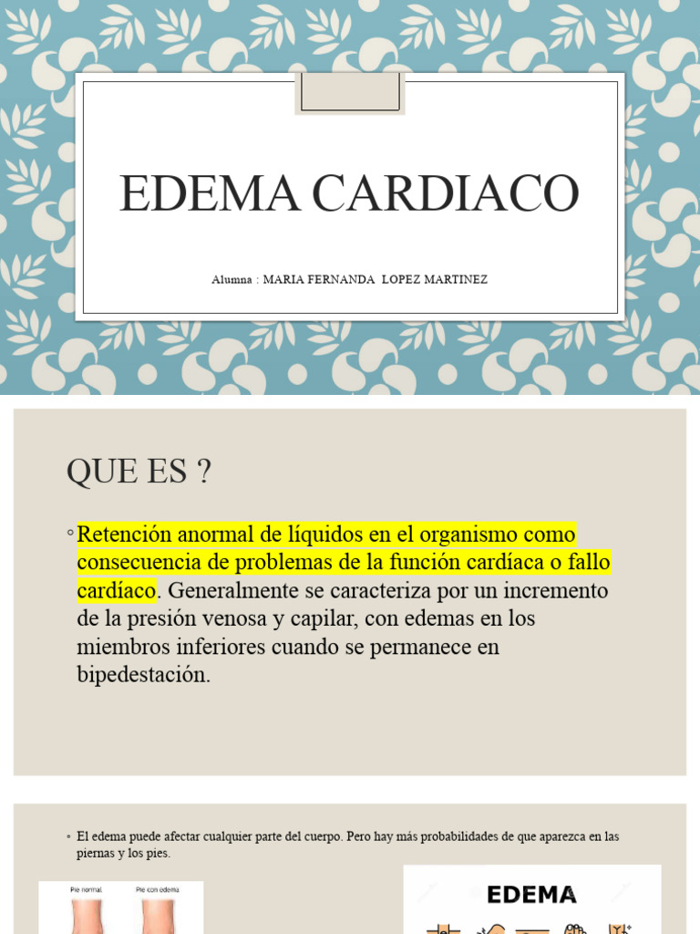 Edema Cardiaco Fer Lopez | PDF | Edema | Corazón