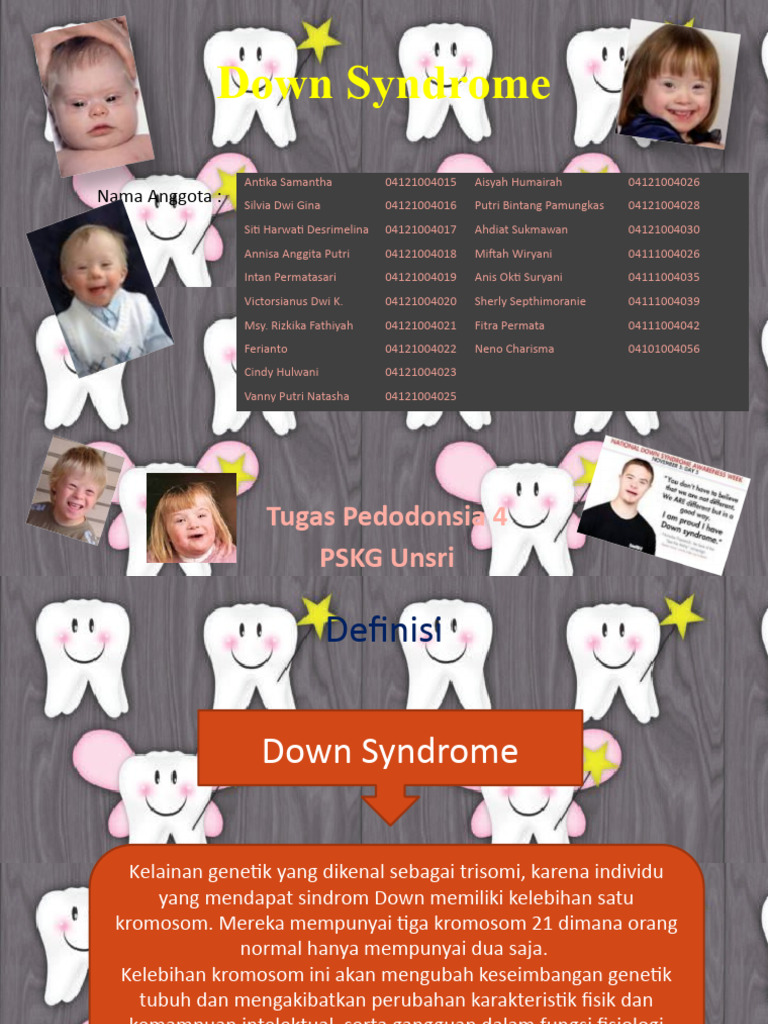 Presentasi Kel Down Syndrome | PDF