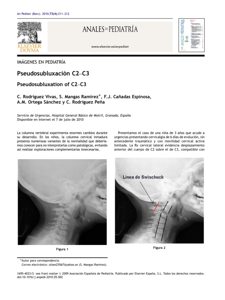 Pseudosubluxacio N C2-C3 | PDF | Medicina CLINICA | Especialidades Medicas