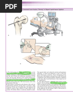 CRPP Femoral Neck | PDF | Hip | Anatomical Terms Of Location