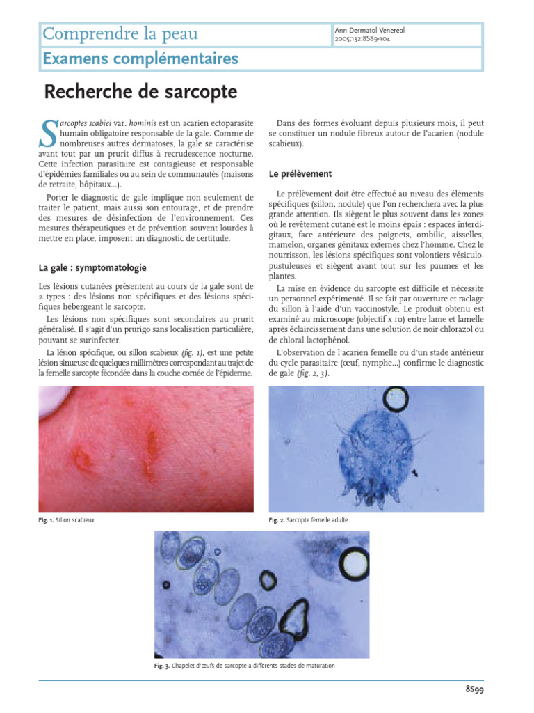 Diagnostic et traitement de la gale | PDF | Maladies et troubles ...
