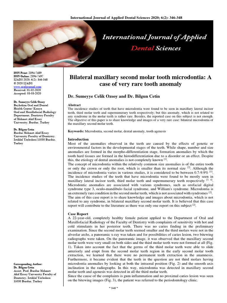Bilateral Maxillary Second Molar Tooth Microdontia: A Case of Very Rare ...