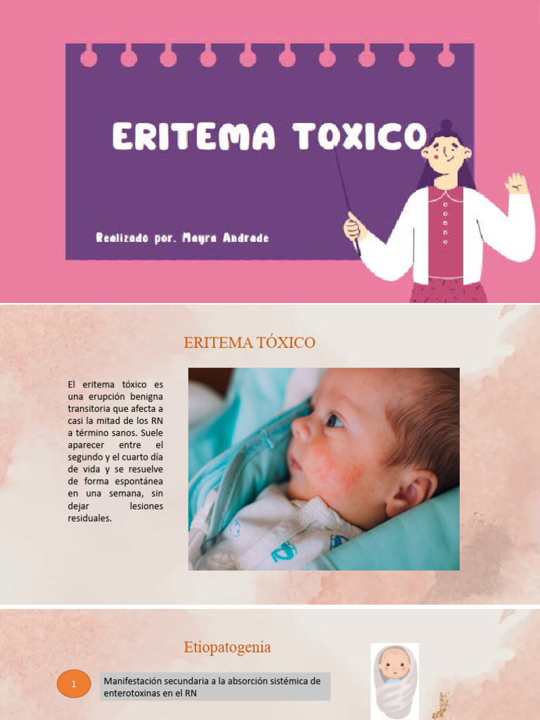 Eritema Toxico | Descargar gratis PDF | Medicina | Epidemiología