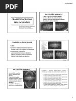 Classificação de Angle: Classes I, II e III | PDF