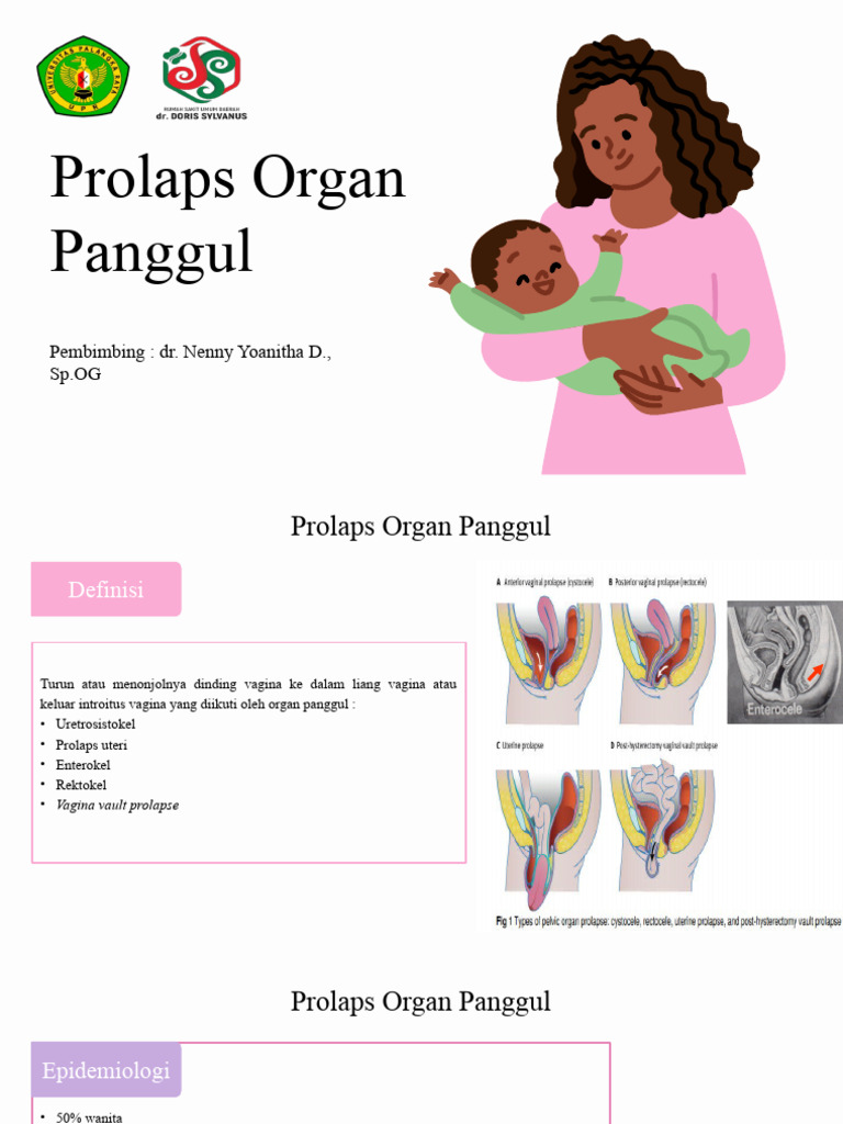 Prolaps Organ Panggul pada Wanita | PDF
