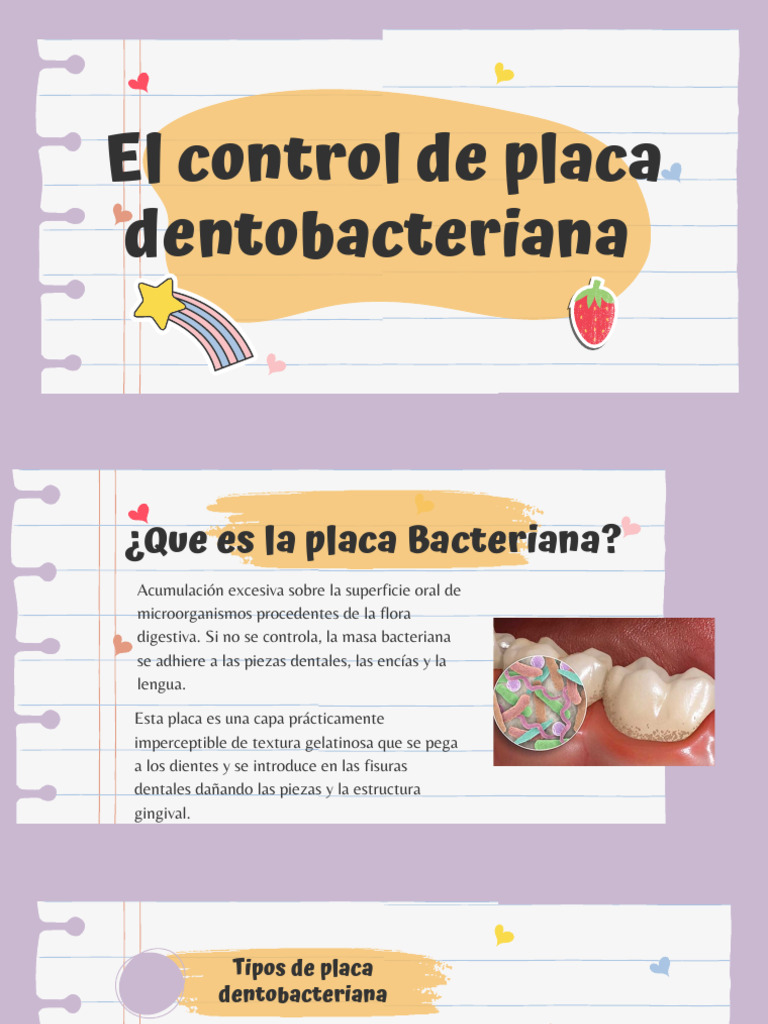 Control de Placa | PDF