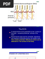 ECG Limb Lead Reversal - LITFL - ECG Library Diagnosis | PDF | Electrocardiography | Internal ...