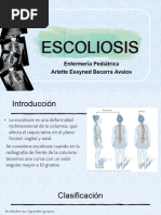 Signo de Risser | PDF | Escoliosis | Rtt