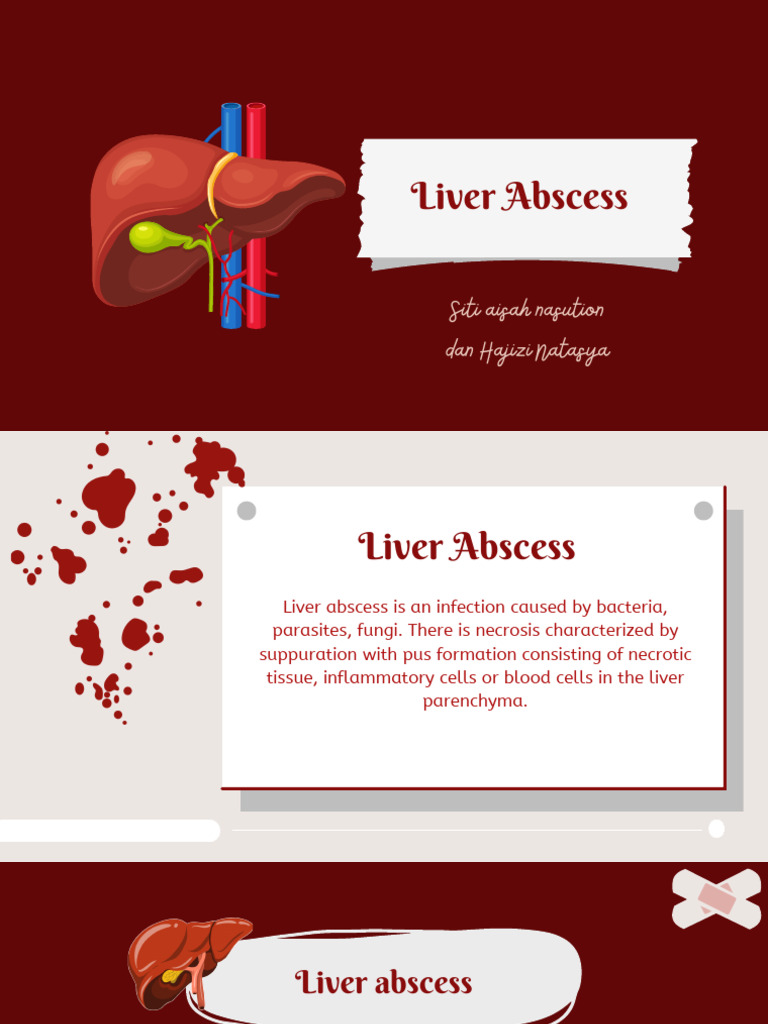 Abses Hati Li 5 | PDF | Liver | Diseases And Disorders