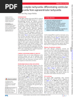Ventricular Tachycardia - Monomorphic VT - LITFL | PDF ...