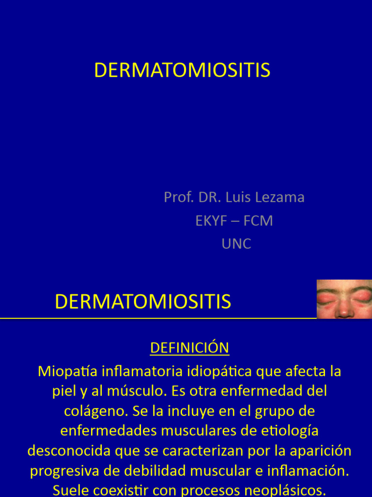 2022-UNC-Dermatomiositis Fisioterapia | PDF | Enfermedades y trastornos ...