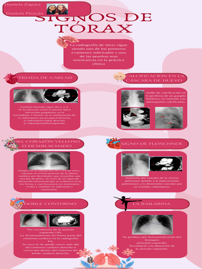 Guía de Signos Radiológicos de Tórax | PDF | Pulmón | Neumonía