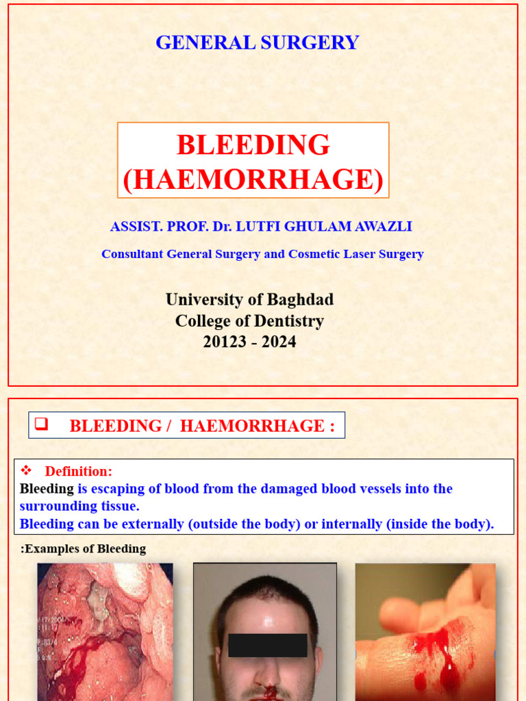 Dentistry l4 Bleeding | PDF | Bleeding | Tissue (Biology)