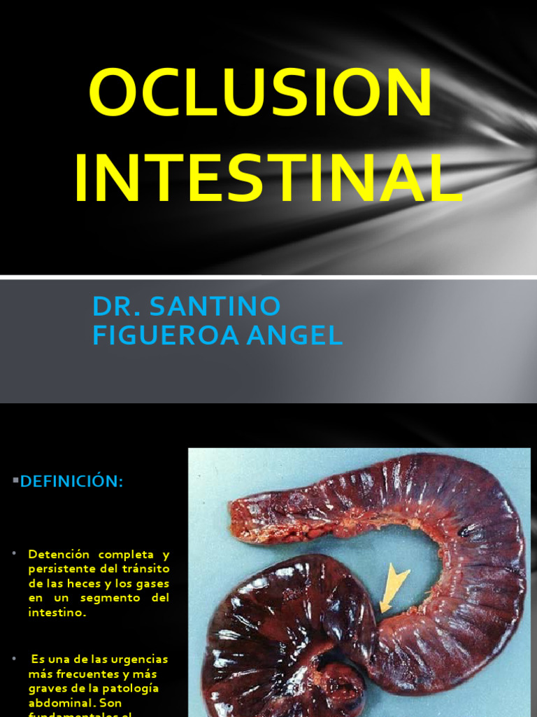 Obstruccion Intestinal | PDF | Septicemia | Tracto gastrointestinal