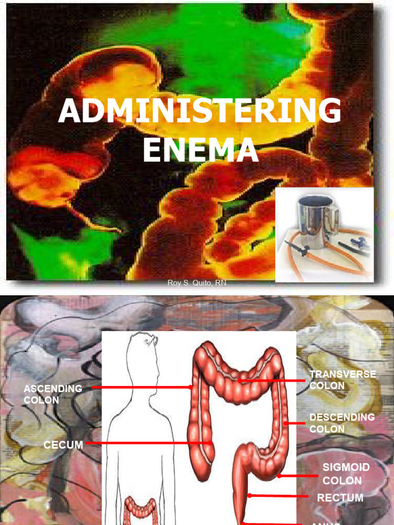 7 Administering An Enema | PDF | Large Intestine | Rectum