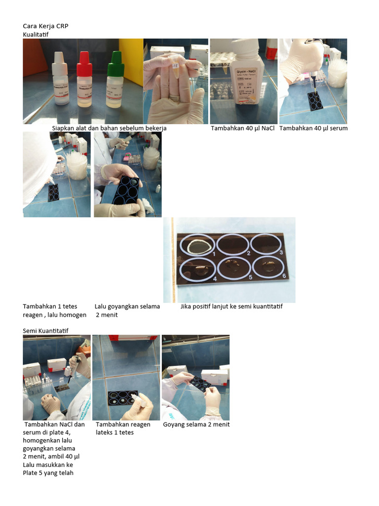 Cara Kerja CRP 1.1 Dan Hasil Pengamatan CRP, ASO, RF | PDF