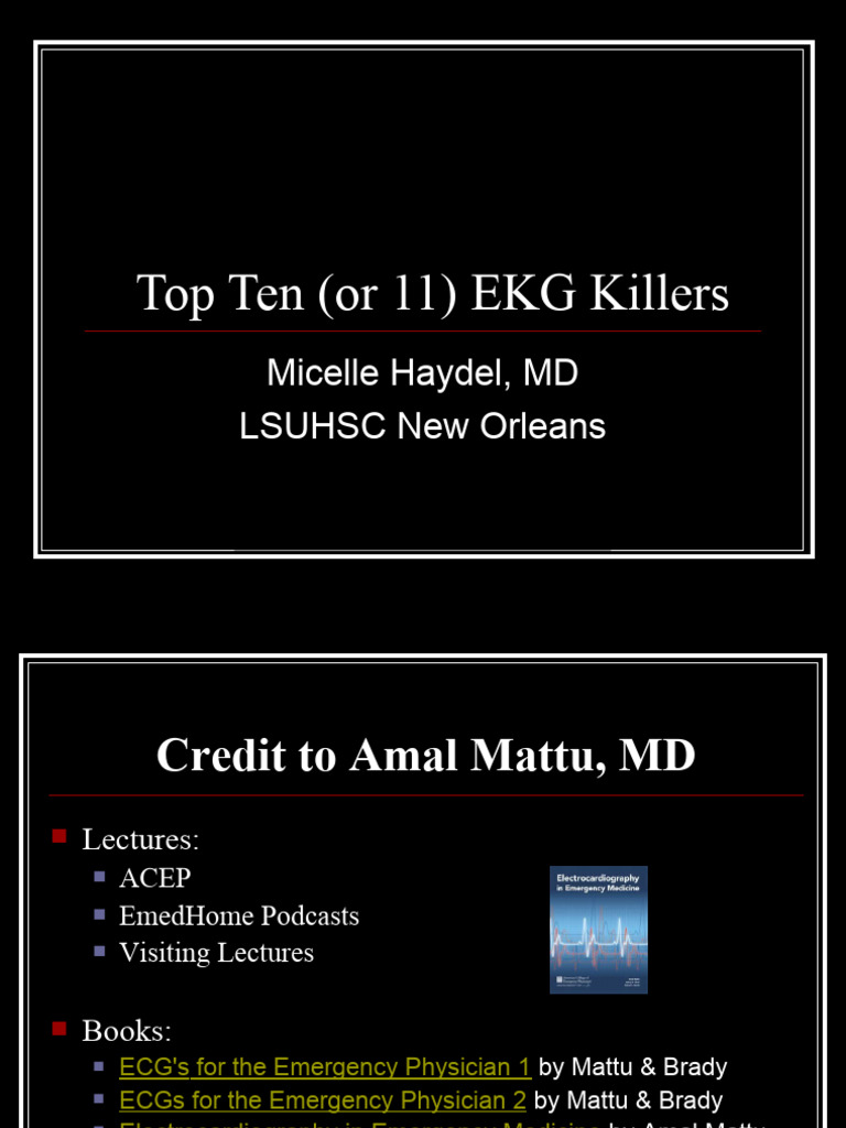Top Ten (Or 11) EKG Killers | PDF | Electrocardiography | Internal Medicine