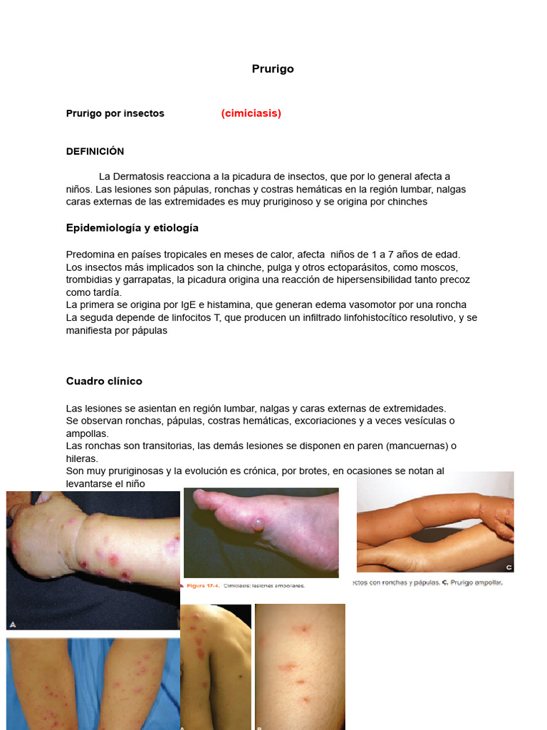 Prurigo: Tipos, Causas y Tratamientos | PDF | Causas de la muerte ...