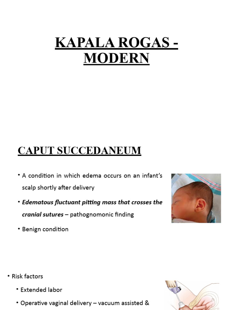 Kapala Rogas - Modern | PDF | Hair Loss | Skin