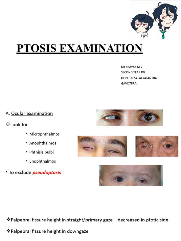 Ptosis Examination | PDF | Cornea | Face