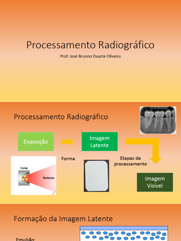 Processamento Radiográfico | PDF | Raio X | Elétron