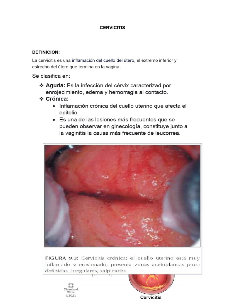 Cervicitis ..Patologia | PDF | Especialidades Medicas | Sistema ...