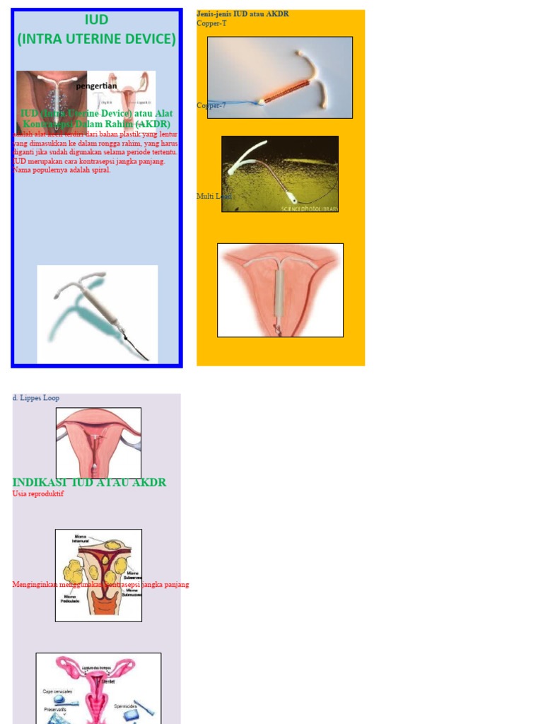 Jenis dan Indikasi IUD Kontrasepsi | PDF