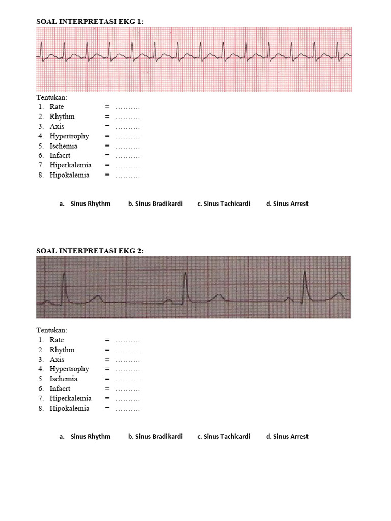 SOAL Interpretasi EKG | PDF
