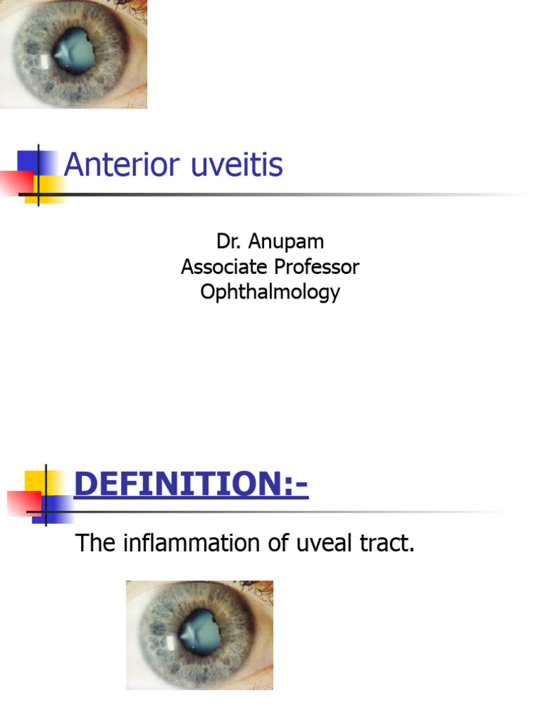 Anterior Uveitis | PDF | Glaucoma | Cornea