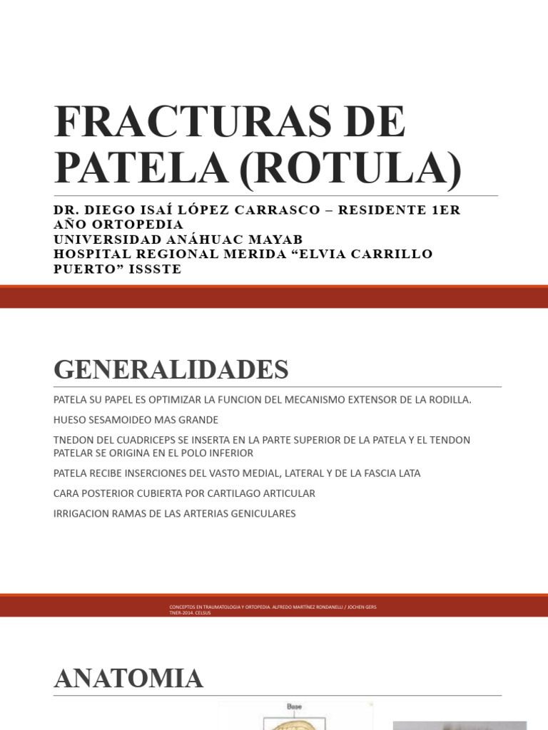 Fracturas de Patela (Rotula) | PDF | Rodilla | Anatomía del miembro ...