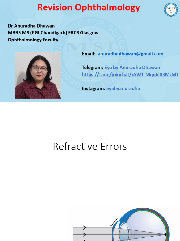Revision Ophtha 2023 | PDF | Glaucoma | Cataract