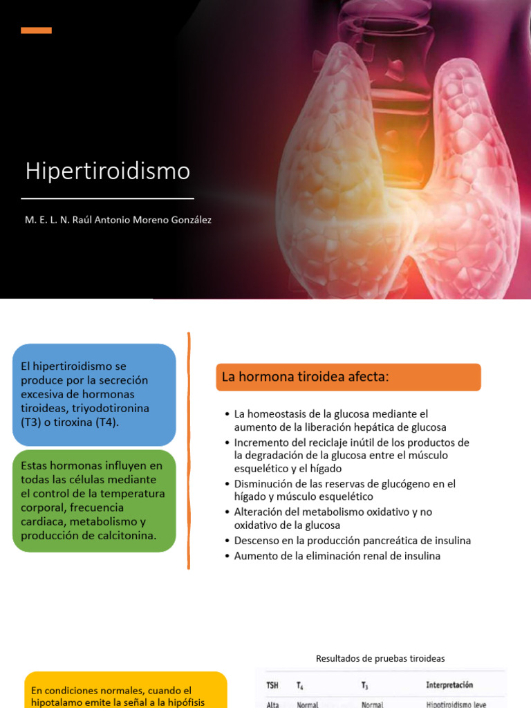 Tratamiento Nutricio en Hipertiroidismo | PDF | Hipertiroidismo | Tiroides