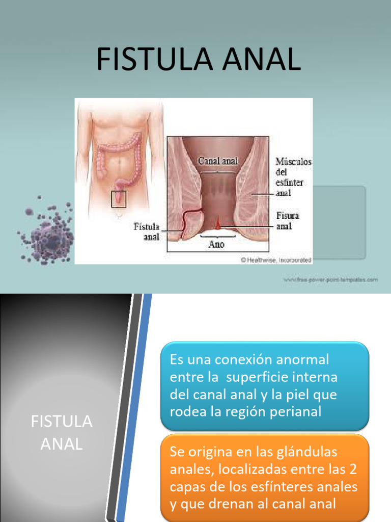 FISURA y FISTULA ANAL | PDF | Especialidades Medicas | Medicina CLINICA