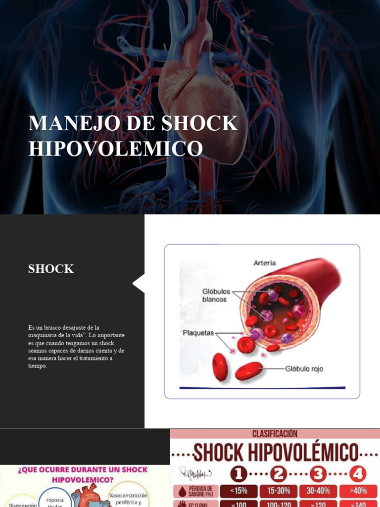 Manejo de Shock Hipovolemico | PDF | Medicina CLINICA | Enfermedades y ...