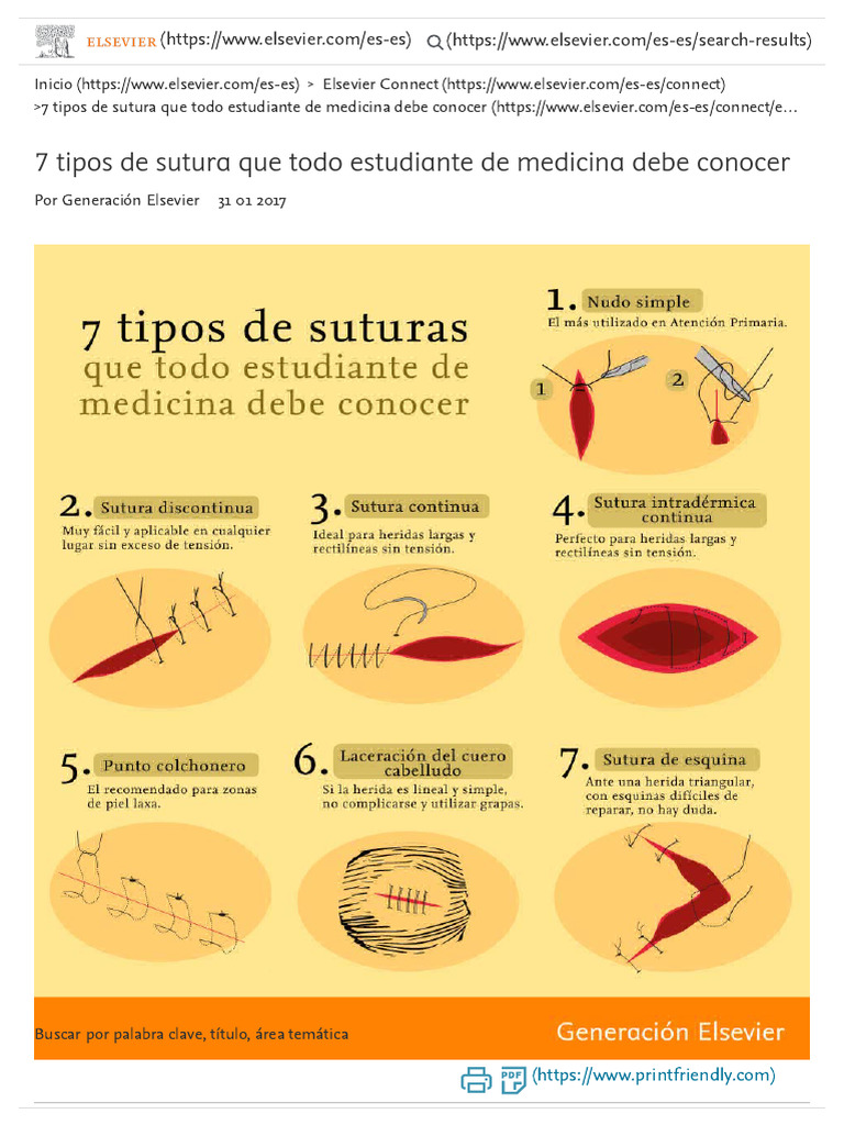 7 Tipos de Sutura Que Todo Estudiante de Medicina Debe Conocer | PDF | Medicina | Publicación