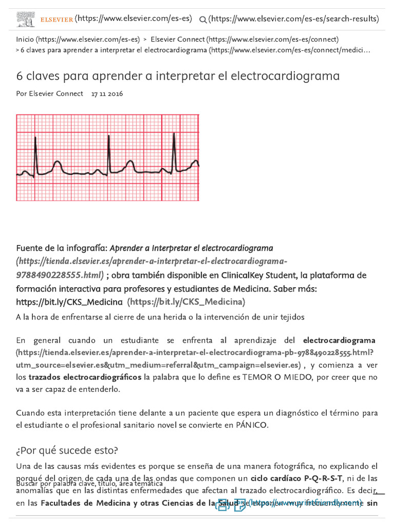 6 Claves para Aprender A Interpretar El Electrocardiograma | PDF | Electrocardiografia | Sistema ...