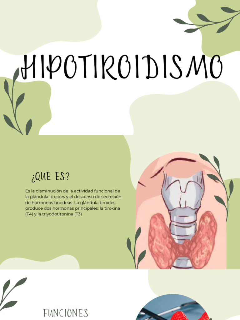 Hipotiroidismo | PDF
