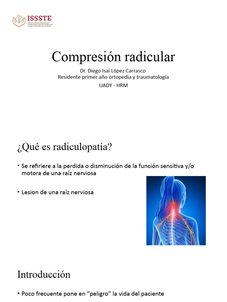 Compresión radicular | PDF | Dolor lumbar | Imagen de resonancia magnética